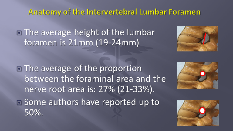 Lumbar Intervertebral Foraminal Anatomy - Doctor Luis Lombardi